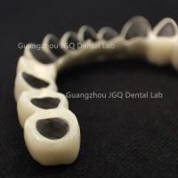 China Dental Pfm Crown and Bridge Restorations for Dental Care China Dental Laboratory for sale