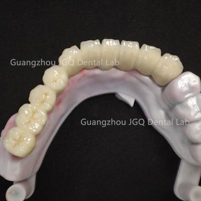 China Dental Pfm Crown and Bridge Restorations for Dental Care China Dental Laboratory for sale