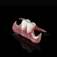 China Valplast Flexible Removable Dentures Aesthetically Dental Prosthesis Pink Base for sale