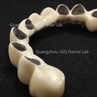 China Porcelain Fused To Metal Pfm Crown Dentures Co-Cr Alloy / Titanium Structure Aesthetic for sale