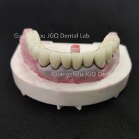China Porcelain Fused To Metal Pfm Crown Dentures Co-Cr Alloy / Titanium Structure Aesthetic for sale