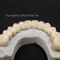 China Porcelain Fused To Metal Pfm Crown Dentures Co-Cr Alloy / Titanium Structure Aesthetic for sale
