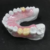 China Removable Flexible Denture Valplast Flexible Partial Dentures Prothesis China Dental Lab for sale