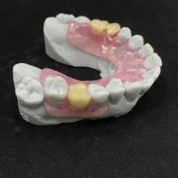 China Removable Flexible Denture Valplast Flexible Partial Dentures Prothesis China Dental Lab for sale