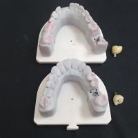China Customized Dental Implant Guides and Dentures 3D Laser Printing CE FDA Certified for sale