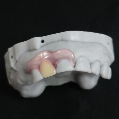 China Acrylic Removable Valplast Denture Durable for Restorative Dentistry for sale