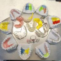 China Hawley Orthodontic Retainer Fr3 Teeth Retainer Acrylic Dentures for sale