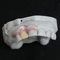 China Personalized Customized Valplast Flexible Denture Durable Natural Looking for sale