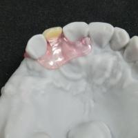 China Personalized Customized Valplast Flexible Denture Durable Natural Looking for sale