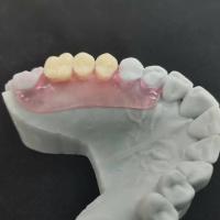 China Invisible Valplast Flexible Denture Removable For Oral Restorations for sale