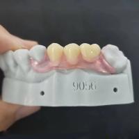 China Invisible Valplast Flexible Denture Removable For Oral Restorations for sale