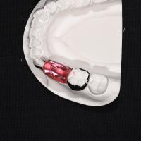China Customized Anti Snoring Guard Space Maintainer For Dentistry Prosthesis for sale