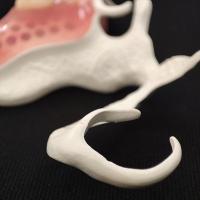 China Peek Material Removable Dentures Customized 3D Laser Printing for Natural Fit for sale