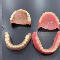China Customized Removable Dentures 3D Laser Printing CE Certified for Secure Fit for sale