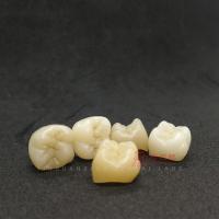 China Denture False Teeth PFZ Crowns Bridges Chinese Dental Lab Customized for sale