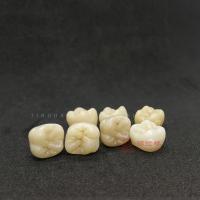 China Denture False Teeth PFZ Crowns Bridges Chinese Dental Lab Customized for sale