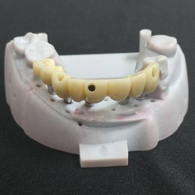 China Customized Dental Zirconia Crown Bridge Implant Bar Using 3D Laser Printing for sale