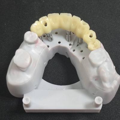 China Customized Zirconia Crown 3D Laser Printing for Dental Implants CE FDA Certified for sale