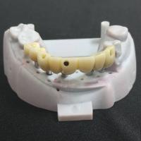 China Chinese Dental Lab Teeth Implants 3D Laser Printing Customized for sale
