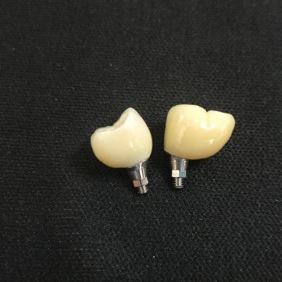 China Chinese Dental Lab Teeth Implants 3D Laser Printing Customized for sale