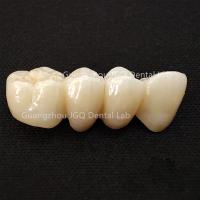 China Denture Restoration Zirconia Crown Dental Bridge Fast Turnaround 2-3 Days Customized for sale