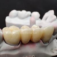 China Denture Restoration Zirconia Crown Dental Bridge Fast Turnaround 2-3 Days Customized for sale
