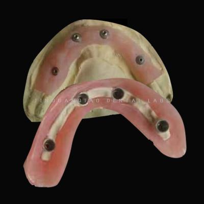 China Permanent Restoration Full Contour Zirconia Crown Dental Implant with Custom Milled Titanium Frame for sale