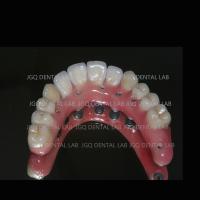 China Monolithic Zirconia Crown Full Jaw Implant Bridge Cement Retained Implant Crown and Bridge for sale