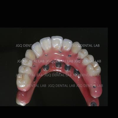 China Monolithic Zirconia Crown Full Jaw Implant Bridge Cement Retained Implant Crown and Bridge for sale