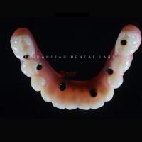 China Multi Unit Abutment Titanium Alloy Zirconia Bridge Dental Implant Durable Prosthesis for sale