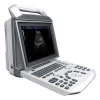 China 256 Gray Scale Ultrasound Machine with USB Connectivity and User-Friendly 68*44.5*24.5cm Packaging Size for sale