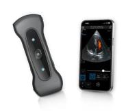 China Aura Series Wireless&Handheld Color Ultrasound System for sale