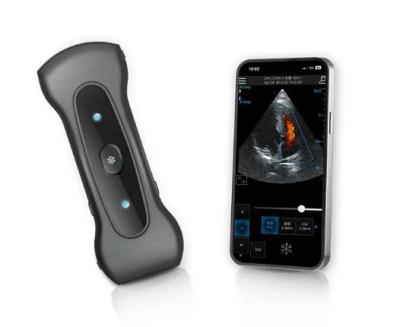China Aura Series Wireless&Handheld Color Ultrasound System for sale