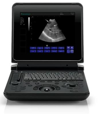 China Black And White Digital Diagnostic Ultrasound System PU-DL121A for sale