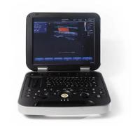 China Cheap Portable Color Doppler Ultrasound Machine PU-L151A for sale
