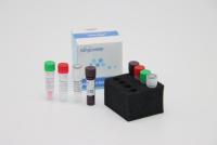 China Treponema Pallidum TP Virus Fluorescent RT PCR Detection Kit 20uL CE for sale