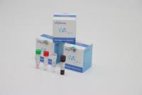 China Lab Reagent RT PCR Test Kit High Stability For Varicella Zoster Virus VZV Detection for sale