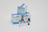 China Real Time RT PCR Detection Kit for SARS-CoV-2 20uL Reaction Volume 4 Fluorescent Channels for sale