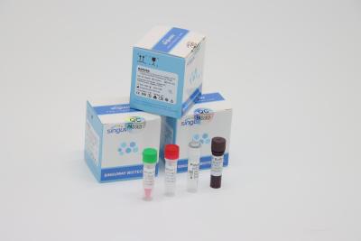 China Real Time RT PCR Detection Kit for SARS-CoV-2 20uL Reaction Volume 4 Fluorescent Channels for sale