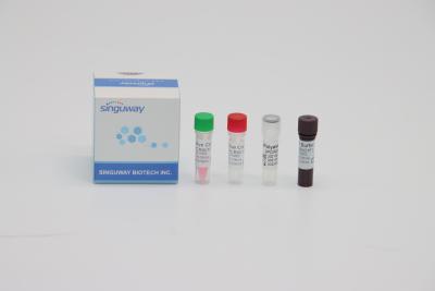 China STB Virus RT PCR Test Kit Fluorescence Probing Rapid Nucleic Acid Testing Kit for sale