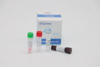 China Quantitative Molecular Diagnosis RT PCR Test Kit Real Time For HPV Tox Virus for sale