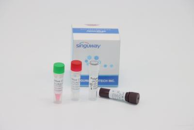 China Quantitative Molecular Diagnosis RT PCR Test Kit Real Time For HPV Tox Virus for sale