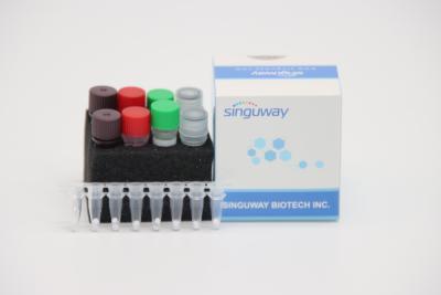 China IVD Quantitative RT PCR Kit for Avian Influenza A Virus H7N9 30 Min 20uL for sale