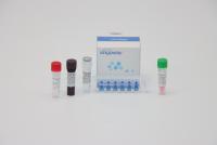 China HPV 16 18 Virus Nucleic Acid Testing RT PCR Test Kit ISO13485 for sale