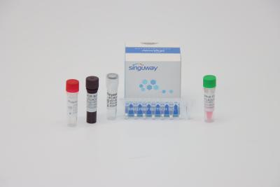 China HPV 16 18 Virus Nucleic Acid Testing RT PCR Test Kit ISO13485 for sale