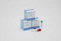 China Rapid RSV Virus RT PCR Test Kit POCT IVD Clinical Diagnosis 20uL High Precision for sale
