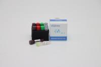 China CE One Step Real Time PCR Kit HSV Rapid Test Kit For Hepatitis B Virus for sale