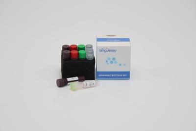 China CE One Step Real Time PCR Kit HSV Rapid Test Kit For Hepatitis B Virus for sale