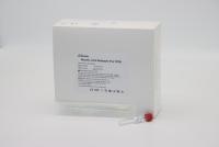 China Pharynx Swab Viral DNA Purification Kit Total Nucleic Acid Extraction 80 Tests for sale