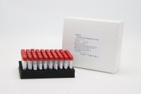 China Nucleic Acid Releaser for PCR Extraction Free Viral RNA DNA Kit 0.5mL 80 Tubes for sale